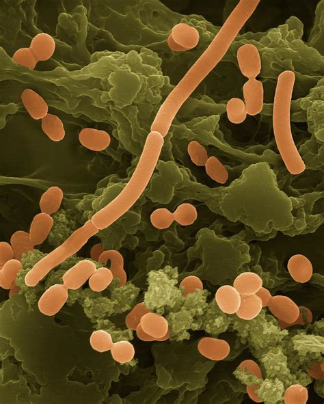 Acinetobacter Sp Photograph By Dennis Kunkel Microscopy Science Photo Library Pixels