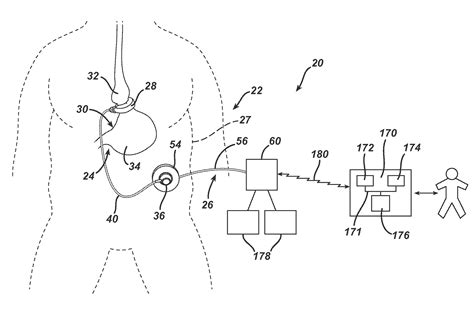 Pulse Characteristics Patented Technology Retrieval Search Results Eureka Patsnap
