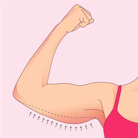 Premium Vector Upper Arm Fat Brachioplasty Liposuction Or Plastic