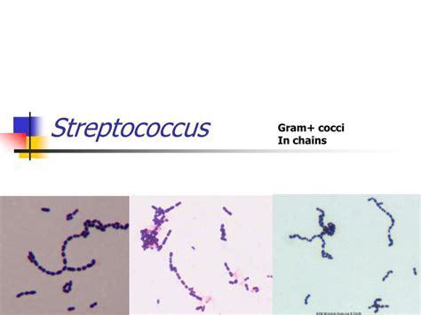 PPT Streptococcus PowerPoint Presentation ID