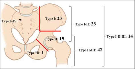 Types Of Pelvic Resection According To Enneking And Dunham 2