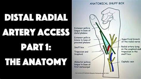 Radial Artery
