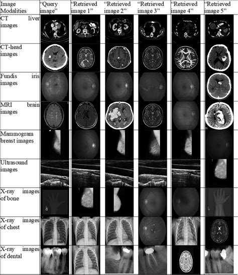 Image Retrieval Using Lbp For Different Medical Images Download Scientific Diagram
