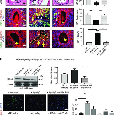Placental Pathology And Nk Cell Accumulation In The Decidua A At Download Scientific Diagram