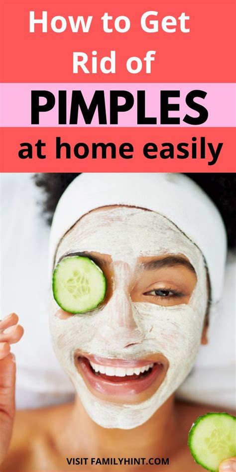 How To Get Rid Of Pimples Overnight 10 Home Remedies For Pimples Artofit
