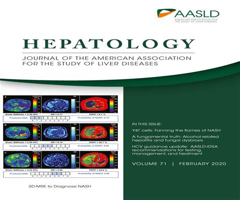 Biliary Atresia Biliary‐enteric Drainage Or Primary Liver T Hepatology