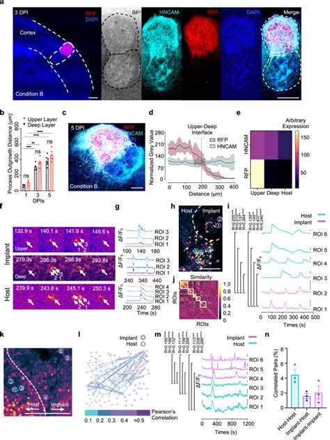 Integration Of 3d Printed Cerebral Cortical Tissue Into An Ex Vivo