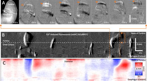 Physiology Of Gastric Motility Patterns Abdominal Key