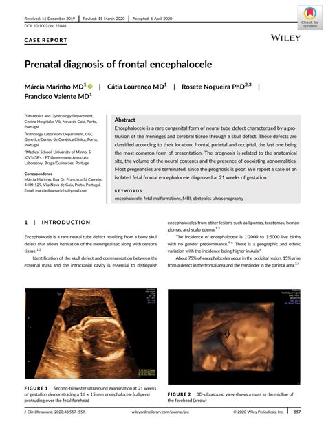 Pdf Prenatal Diagnosis Of Frontal Encephalocele