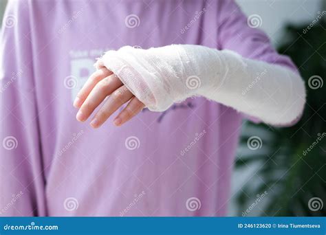 Broken Hand Cast Girl