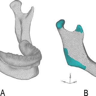 Meshing And Fixation Of The Finite Element Analysis FEA Model The Download Scientific