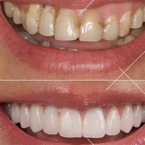12 Avaliações Sobre Dr Thiago Noronha Phd Ortodontia Invisalign