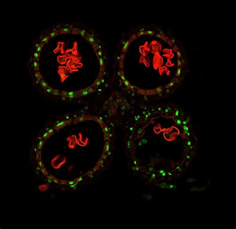 细胞凋亡：早期与晚期的不同阶段