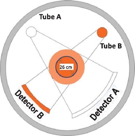 Diagram Of Dual Source Ct Scanner Used For Simultaneous Acquisition Of Download Scientific