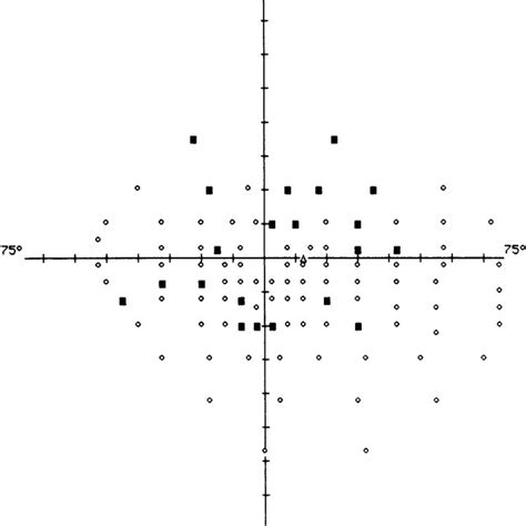 Esterman Visual Field Test Score For Diff Erent Field Types Left Download Scientific Diagram