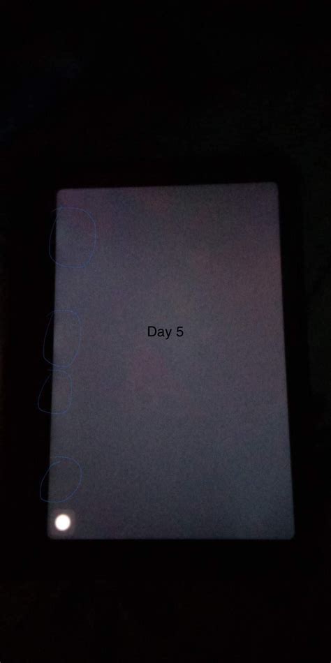 One More Ask If My Screen Bleed Lessen An… Apple Community