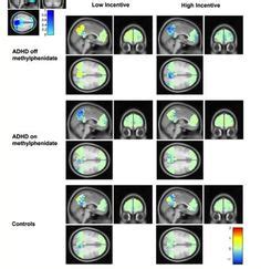 11 Default Mode Network Ideas Networking Default Cingulate Cortex