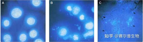 总结 6种细胞培养生物污染物常见类型 知乎