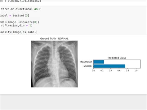 Pneumonia Classification Using Pytorch