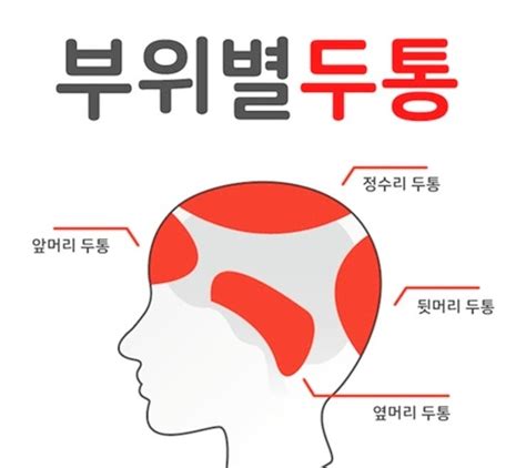 편두통 두통 원인 머리 찌릿 증상 및 스트레스 두통 없애는법 네이버 포스트