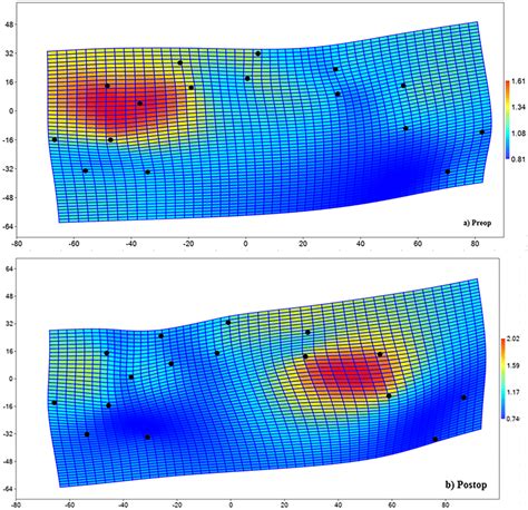 A Thin Plate Spline Demonstrating The Average Cc Shape Deformation For