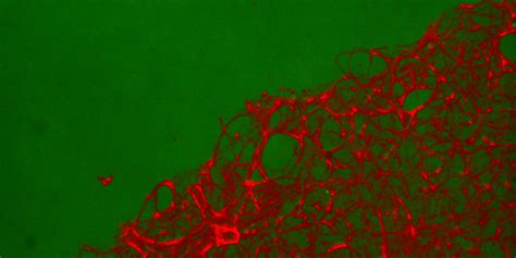 Cu Cancer Center Member Receives Department Of Defense Grant For 3d