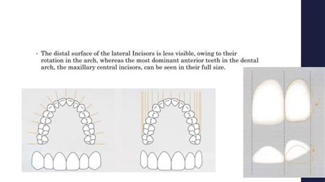 Esthetic Considerations In Fixed Partial Dentures Pptx