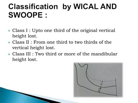 Residual Ridge Resorption Pptx