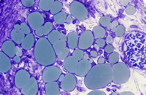 Human Fat Cells Light Micrograph Stock Image C029 6630 Science Photo Library