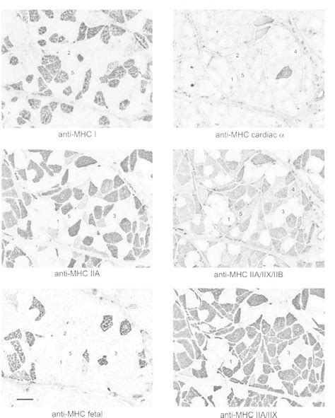 figure 3 from uva dare digital academic repository motor unit