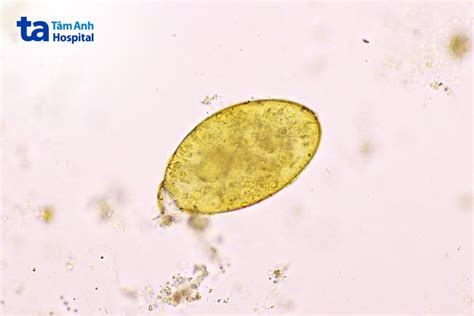 Giun Kim Kí Sinh ở đâu Hình ảnh đặc điểm Cấu Tạo Cách Di Chuyển