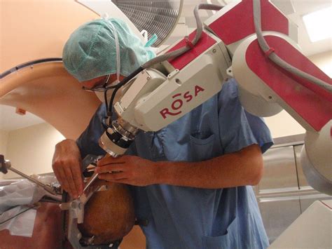 Robot That Assists In Brain Surgery Cuts Procedure Time In Half