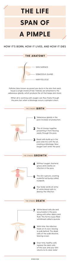 Pimples How Do They Form And How Long Do They Last Pimples Skin Treatments Skin