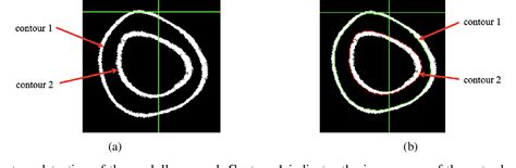 Figure 10 From Skeleton Based 3d Femur Shape Analysis System Using Maximum Minimum Centre