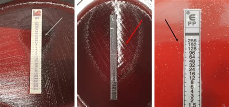 Minimum Inhibitory Concentration Mic Determination Using A Download Scientific Diagram
