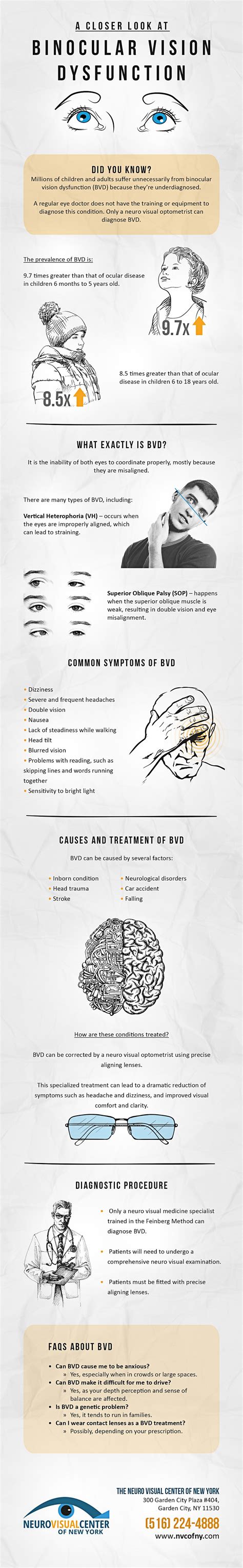 Binocular Vision Disorder Ulsdthinking
