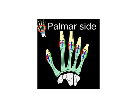 Ligaments Of The Mcp Joints Quiz