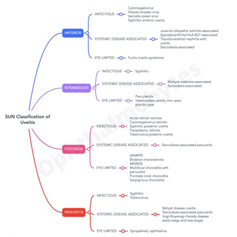 Sun Classification Of Uveitis — Ophthalmobytes