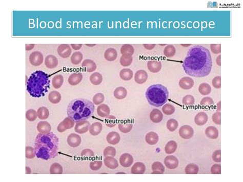 Differential Leukocyte Count With Diagram At Thomas Simpson Blog