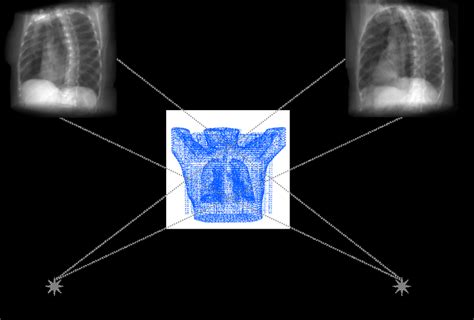 Dual X Ray Setup Two X Rays Irradiate The Patient And Their Real Time Download Scientific