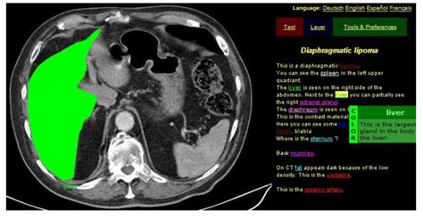 User Site The Annotations Are Automatically Cross Linked To The Text Download Scientific