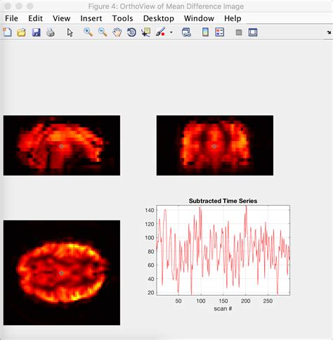 Fasl Tutorial 5 Examining The Results — Andys Brain Book 1 0