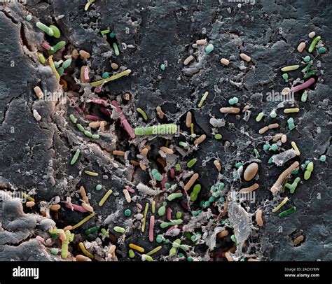 Intestinal Bacteria Scanning Electron Micrograph Sem Of Various Bacteria Found On The End Of