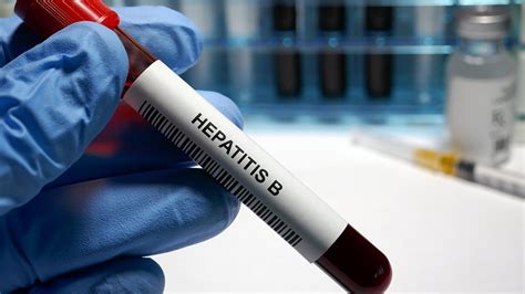 Woman Tests Positive For Hepatitis B After New Jersey Surgery Center