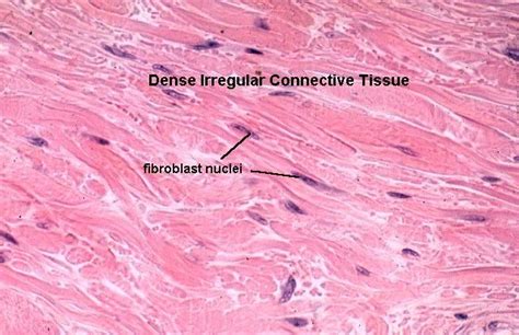 Dense Irregular Connective Tissue Is Found In Morgan Harper Nichols