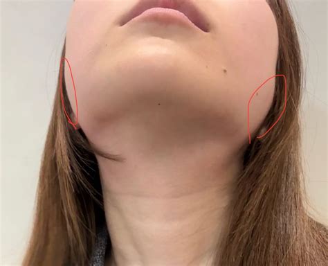 의사에게 물어보세요 이미지 첫 번째 빨 강남언니 1등 성형수술and피부시술 정보앱