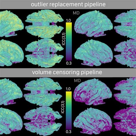 3d Rendering Of Testretest Variability Var Maps Of Tract‐based Download Scientific Diagram