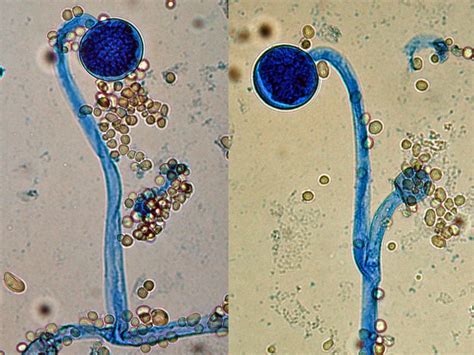 Mucor An In Depth Examination Of Morphological Features And