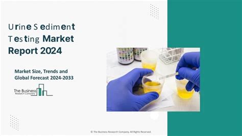 Ppt Urine Sediment Testing Market Size Share Trends Growth And