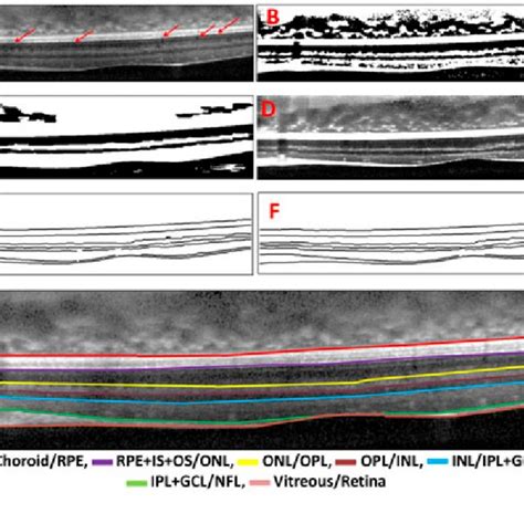 An Overview Of The Two Dimensional Segmentation Procedures For The Oct